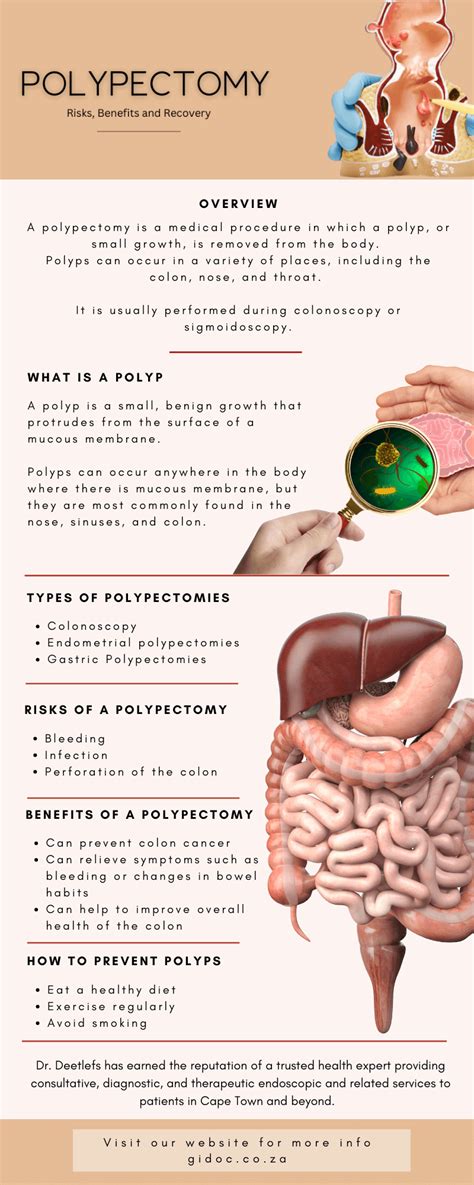 Understanding A Polypectomy Risks Benefits And Recovery Gidoc Cpt