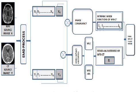 Figure 1 From Mri Ct Fusion Based On Phase Congruency Of Intrinsic Functions And Laplacian Of