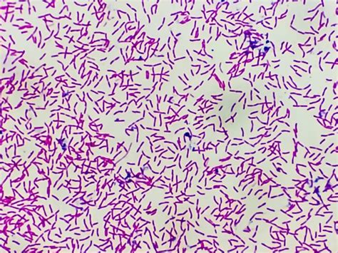 Microscopic View Of Gram Stain Showing Rod Shape Escherichia Coli Or E Coli Bacteria Premium