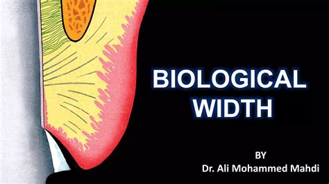 Biological Width By Drali Mohammed Abutrab Ppt