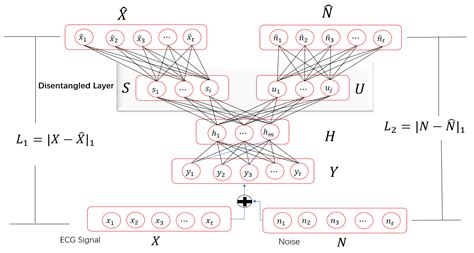Electronics Free Full Text Ecg Signal Denoising Method Based On