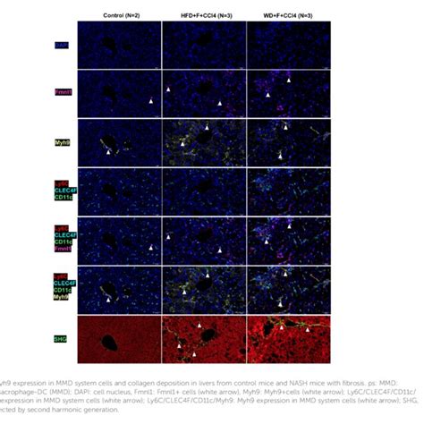 Scrna Seq Profiling Of Liver Cells From Normal And Nash Mice With