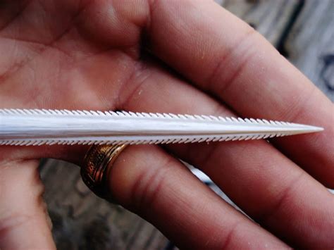 Ouch Doctor Removes Giant Stingray Barb Stuck In Mans Foot Elite