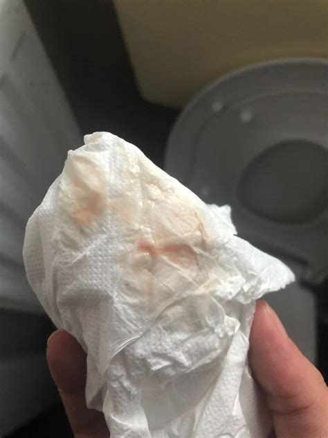 What Does Implantation Bleeding Look Like On Toilet Paper
