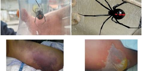 Reaparece La “viuda Negra” Registro Oficial De Ataque En Yucatán
