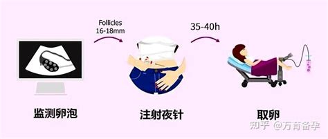 常见的6种促排方案哪种促排方案适合你 知乎