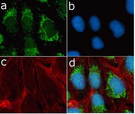 Anti Mtor Antibody Rp23040085 Ab313429 Abcam