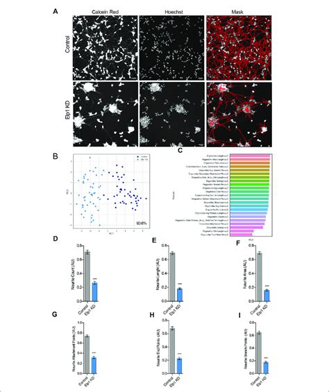 Elp1 Is Involved In Neurite Morphology Depletion Of Elp1 Causes