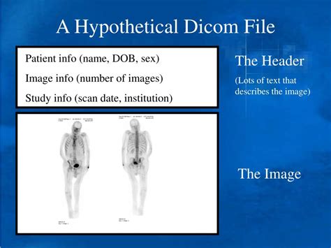 Ppt Diy Dicom Server Powerpoint Presentation Free Download Id