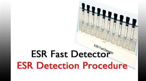 Esr Fast Detector Procedure