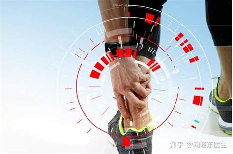距骨骨软骨损伤半年走路还是疼，必须要做手术吗？ 知乎