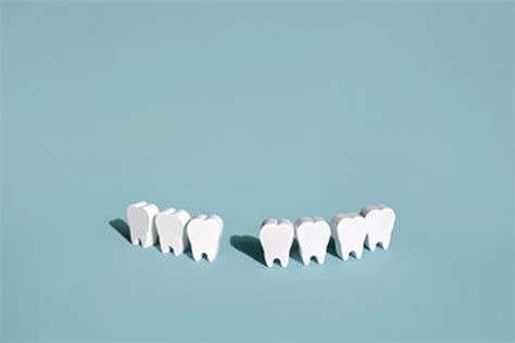 What Are The Consequences Of Ignoring Missing Teeth Advanced