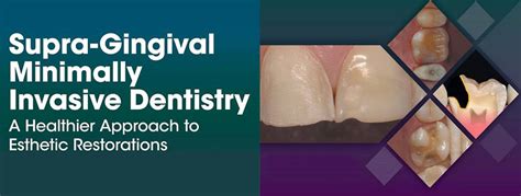 Minimally Invasive Dentistry Dentist In Redding Ca