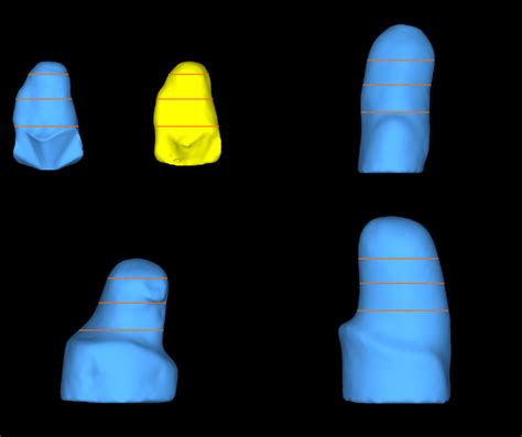 Diameter Measurements Across All Models Comparison For Both SW And Download Scientific