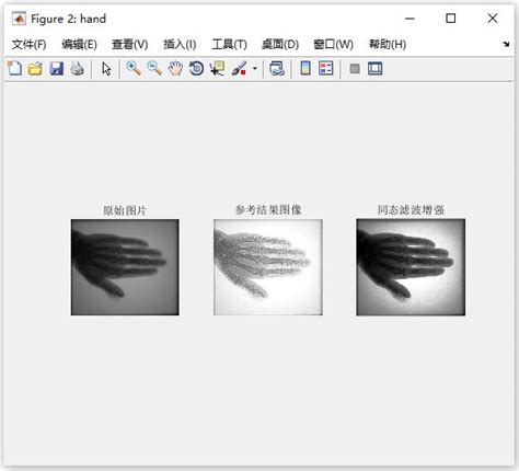 【b29】基于matlab医学图像增强 使用同态滤波的方法 图像处理 索炜达电子