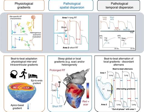 High Density Isochronal Repolarization Mapping And Re Entry