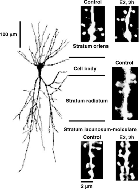 Figure 1 From Comparison Between Basal And Apical Dendritic Spines In