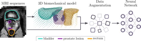 The Proposed Anatomy Informed Prostate Augmentation Simulating Typical Download Scientific