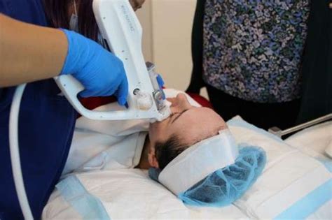 Unlock Radiance With Microtox Treatment Melbourne Est Clinic