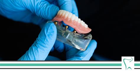 Protezy na implantach propozycje rozwiązań dentalcentrum pl