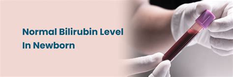 High Bilirubin In Newborns Causes Factors And Solutions