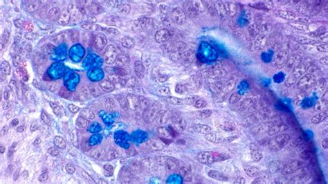 Scientists Discover Previously Unknown Anatomical Structure In The