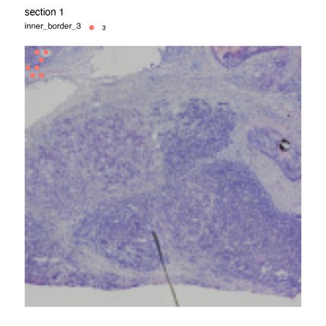 Region Neighbors • Semla