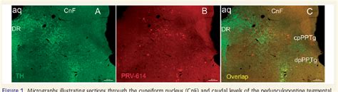 Figure 1 From The Cuneiform Nucleus May Be Involved In The Regulation Of Skeletal Muscle Tone By