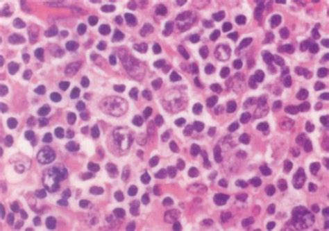 Disorders Of The Equine Hemolymphatic System Iii Flashcards Quizlet