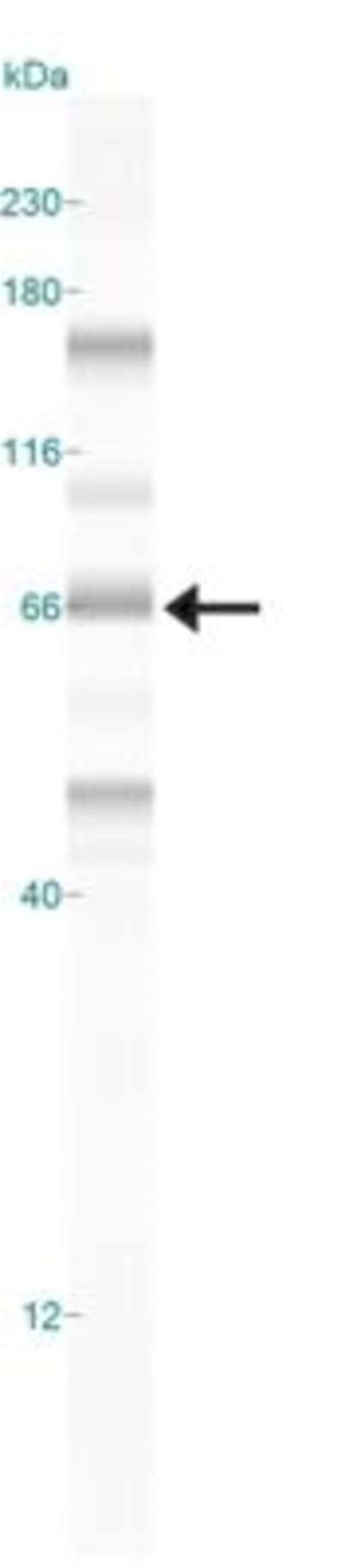 Anti Lrh 1nr5a2 Polyclonal Novus Biologicalslife Sciences