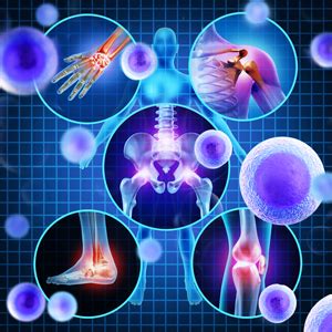 Biologic Therapy Miami Fl Hyaluronates Prp Therapy Miami Fl