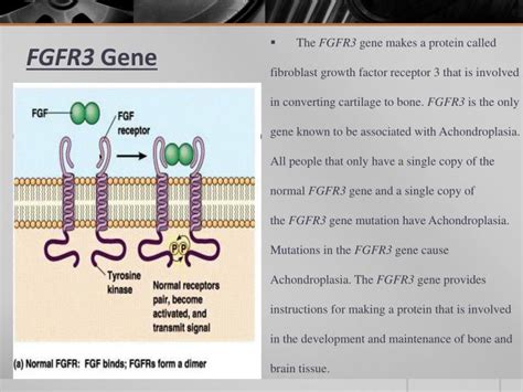 Ppt Achondroplasia By Justin Baker Powerpoint Presentation Id2041667