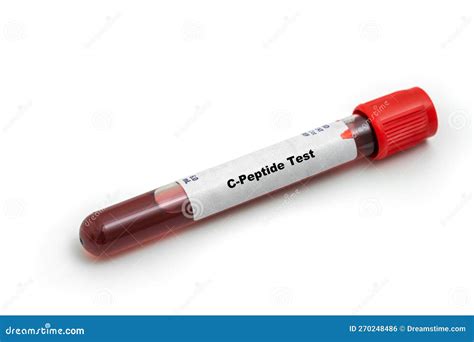 C Peptide Test Medical Check Up Test Tube With Biological Sample Stock