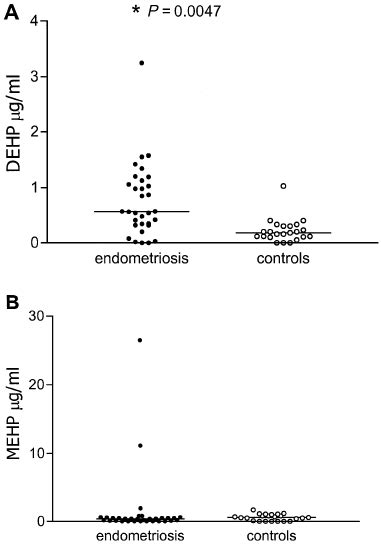 Plasma Concentrations Of Dehp A And Mehp B In Patients With