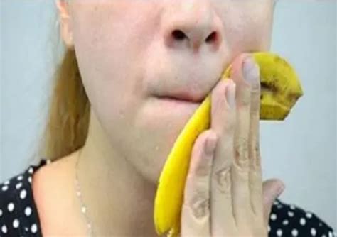 Ela passa casca de banana na pele Você vai fazer o mesmo quando souber