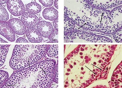 A Normal Maturation Of Germ Cells In The Seminiferous Tubules In The