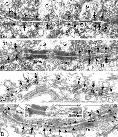 Electron Microscopy Of Ultrathin Sections Through Bovine Liver Tissue Download Scientific