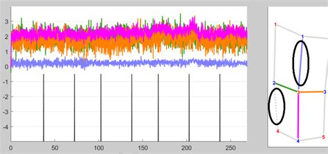Cannot Edit Markers In Homer 3 Homer3 And Atlasviewer Openfnirs Forum