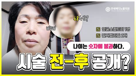 69세 여성 팔자주름 피부과 효도선물 Youtube
