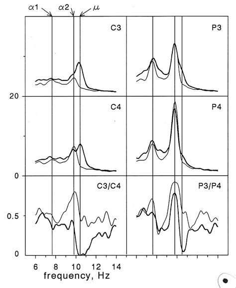 How Do We Analyze Eeg Data To Detect Whether Mu Wave Frequencies 8 13