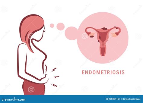 Meisje Met Endometriose En Pijn Vrouwen Gezondheidsanatomie Info