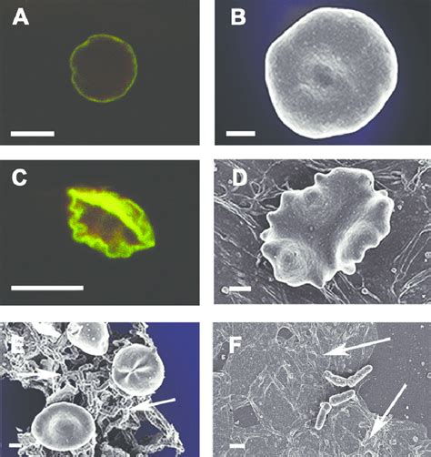 confocal and scanning electron microcopy sem of health and