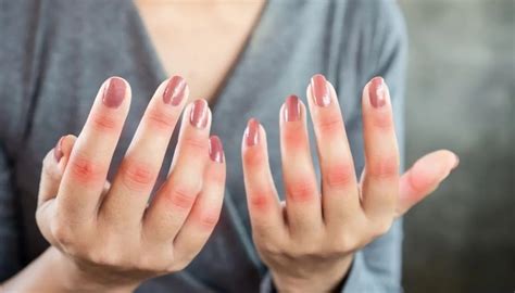 Traugel gel opiniones foro precio ingredientes donde comprar mercadona España