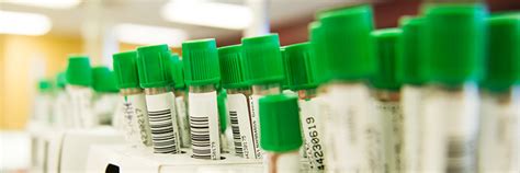 Tspot Oxford Diagnostic Laboratories