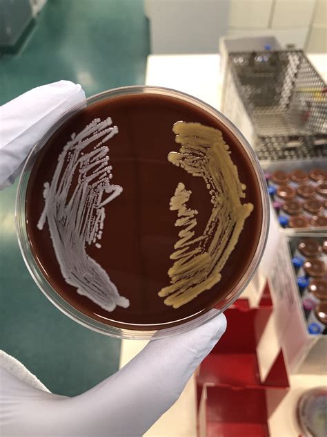 Staphylococcus Aureus Complex S Argenteus Bug Of The Week