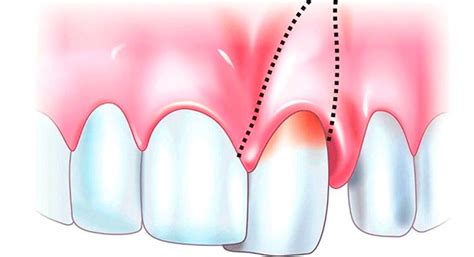 Хитаються зуби що робити