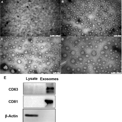 Morphology And Size Of Exosomes Under Transmission Electron Microscopy