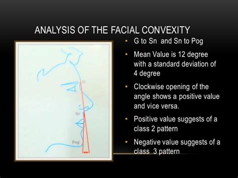 Soft Tissue Cephalometric Analysis For Orthognathic Surgery
