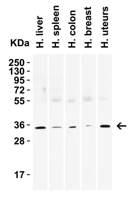 Siglec15 Polyclonal Antibody Pa5 114527