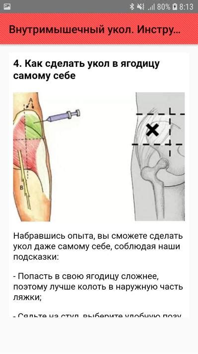 Внутримышечный укол. Инструкция para Android - APK Baixar